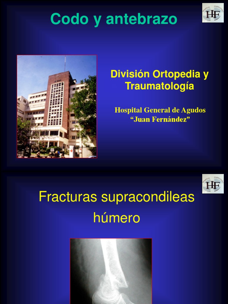 Fracturas de Codo y Antebrazo: Clasificación y Tratamiento | PDF | Codo ...