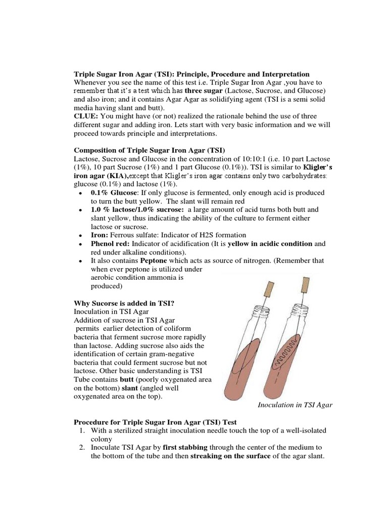Triple Sugar Iron Agar