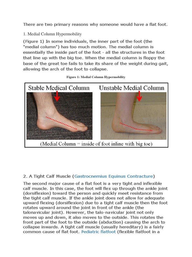 Figure 1: Medial Column Hypermobility | PDF | Foot | Ankle