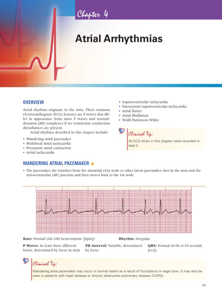 ECG Mastery Improving Your ECG Interpretation Skills | PDF ...