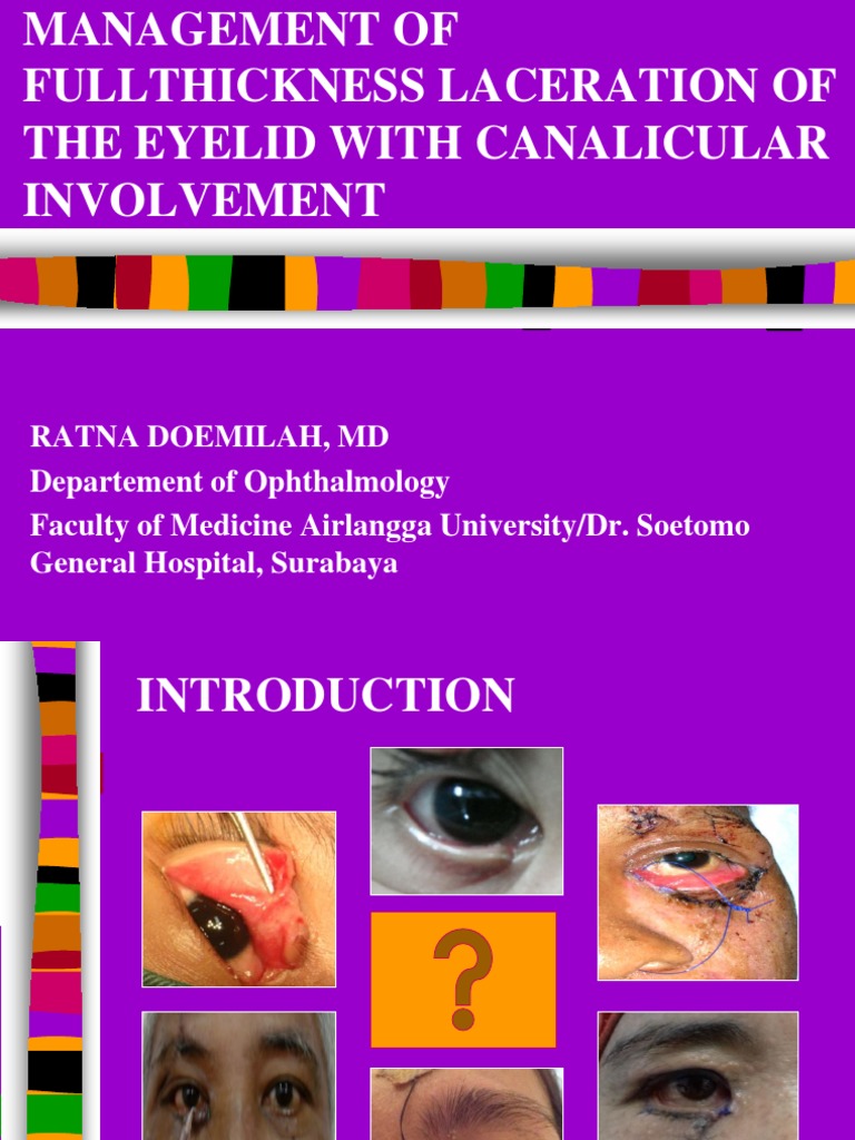 Managing Full-Thickness Eyelid Lacerations With Canalicular Involvement ...