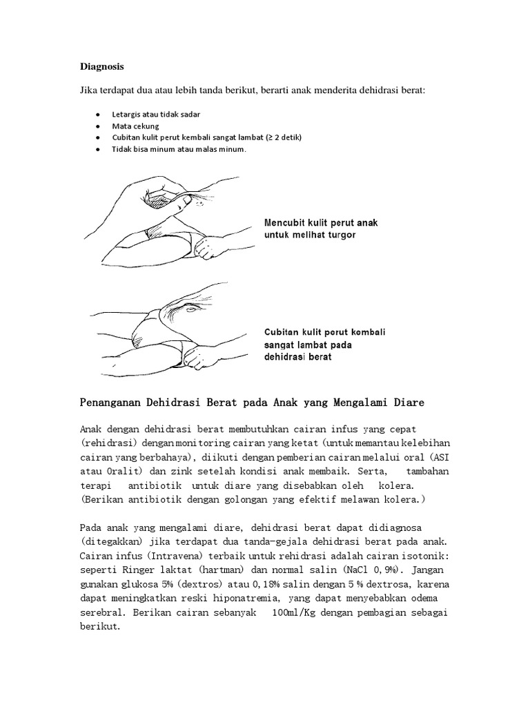 Diare Dehidrasi Berat Pada Anak | PDF