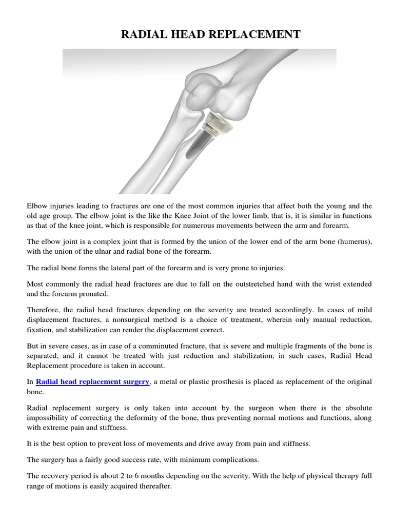 Radial Head Replacement Surgery Overview | PDF