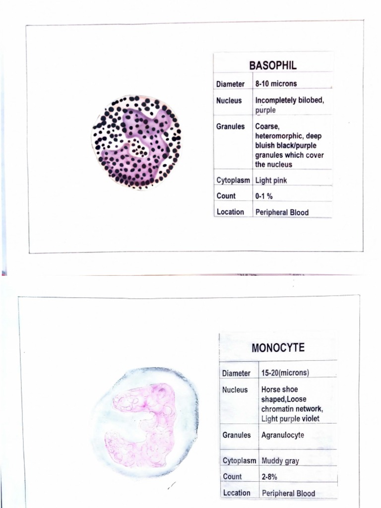 Basophil: Diameter 8-10 Microns Nucleus LN Ompletely Bilobed | PDF ...