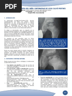 Reflejos Osteotendinosos: Bicipital y Tricipital | PDF