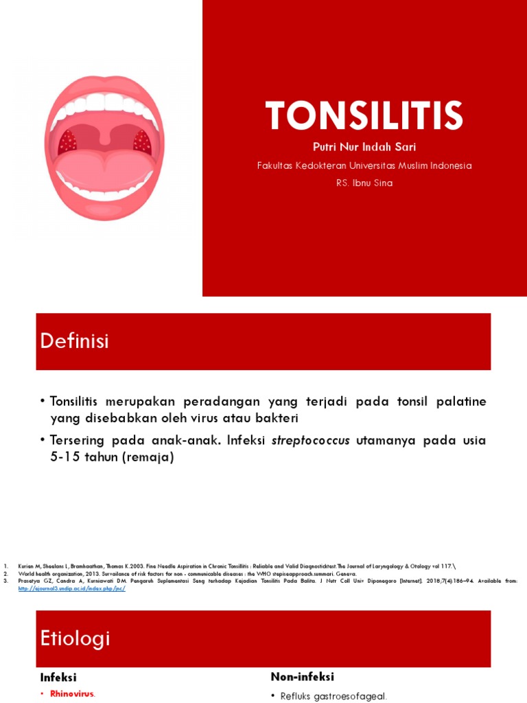 Tonsilitis | PDF