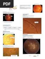 Transposition | PDF | Lenses | Optics