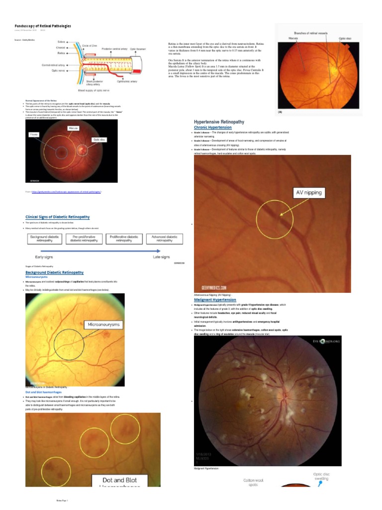 Fundoscopy Insights on Retinal Pathologies | PDF | Retina | Glaucoma
