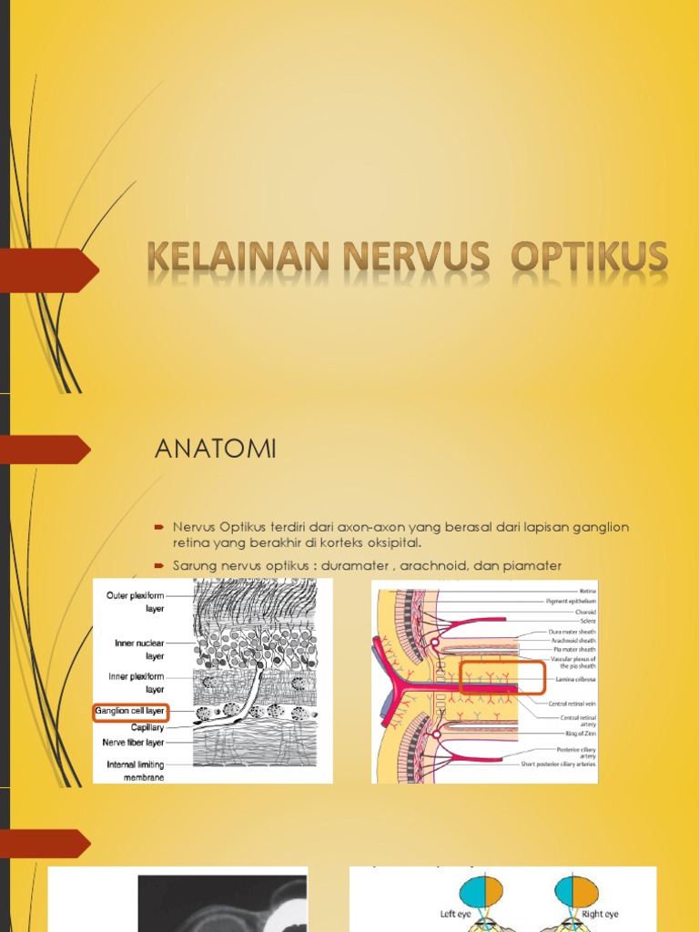 Kelainan dan Penanganan Saraf Optik | PDF | Sains & Matematika