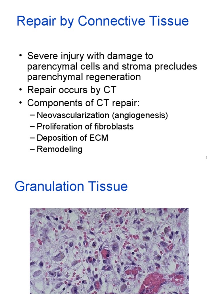 Pathology, Lecture 9, Tissue Repair #3 (Slides) | PDF | Pathology ...