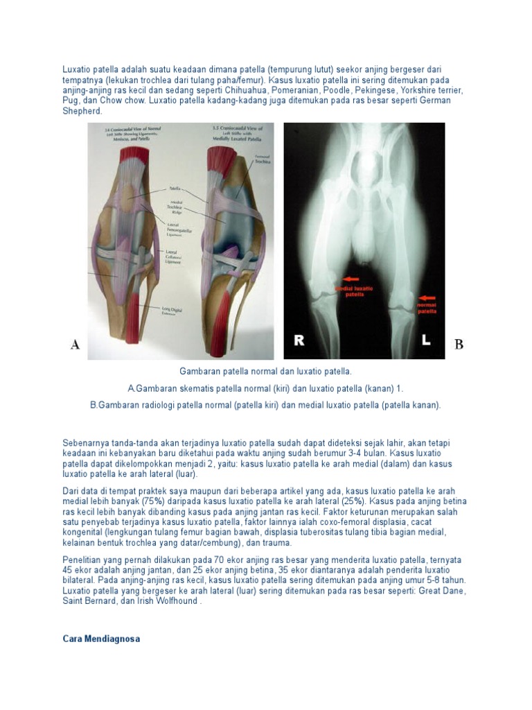 Luxatio Patella Adalah Suatu Keadaan Dimana Patella | PDF