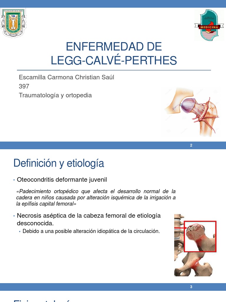Enfermedad de Legg Calvé Perthes | PDF | Cadera | Hueso