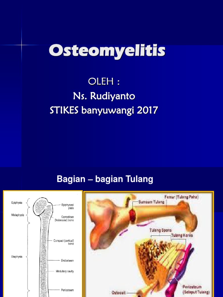 Panduan Lengkap Osteomyelitis dan Diagnosa | PDF