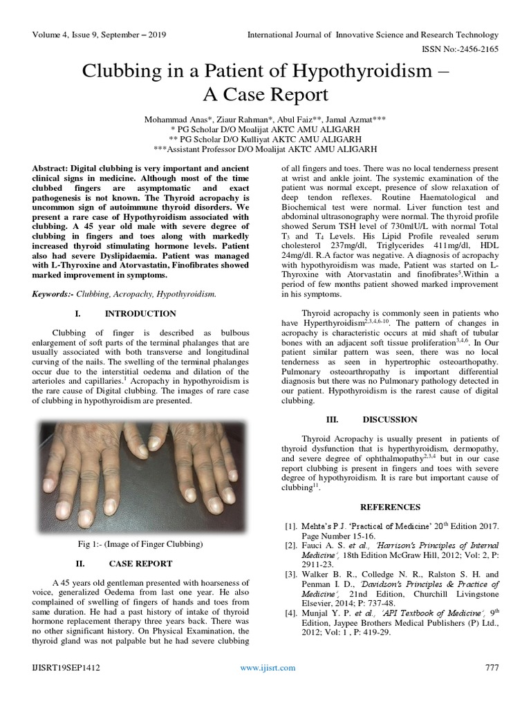 Clubbing in A Patient of Hypothyroidism - A Case Report | PDF ...