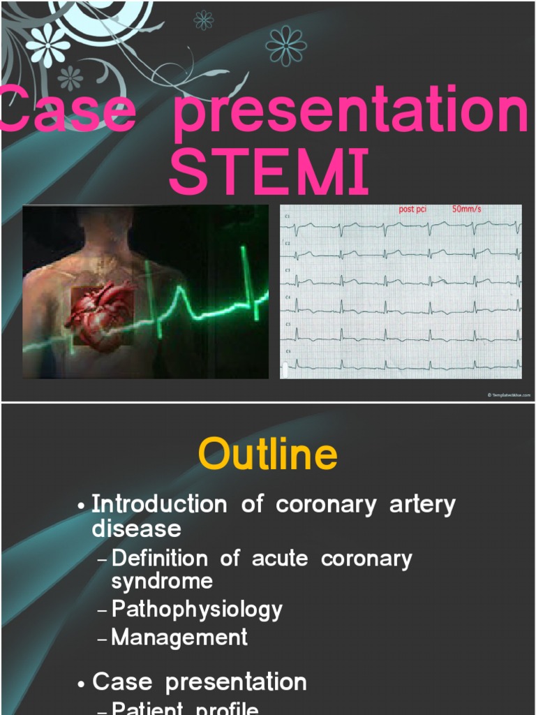 STEMI.ppt แก้ไข 14 11 53 | PDF