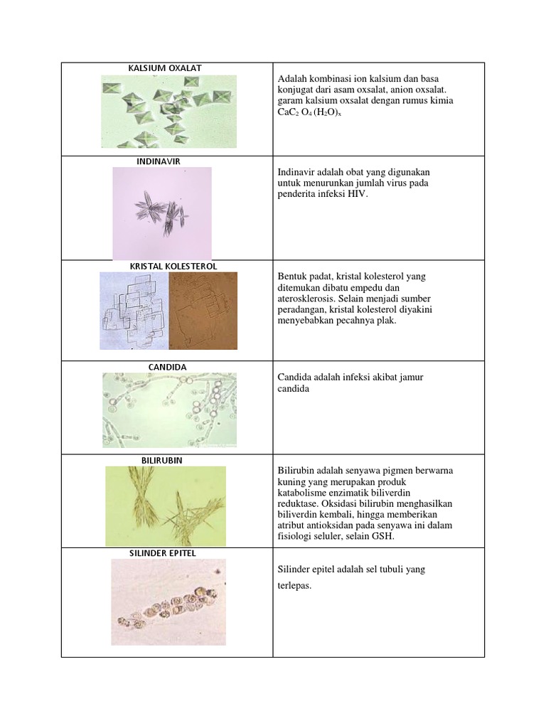 Atlas Sedimen Urin | PDF
