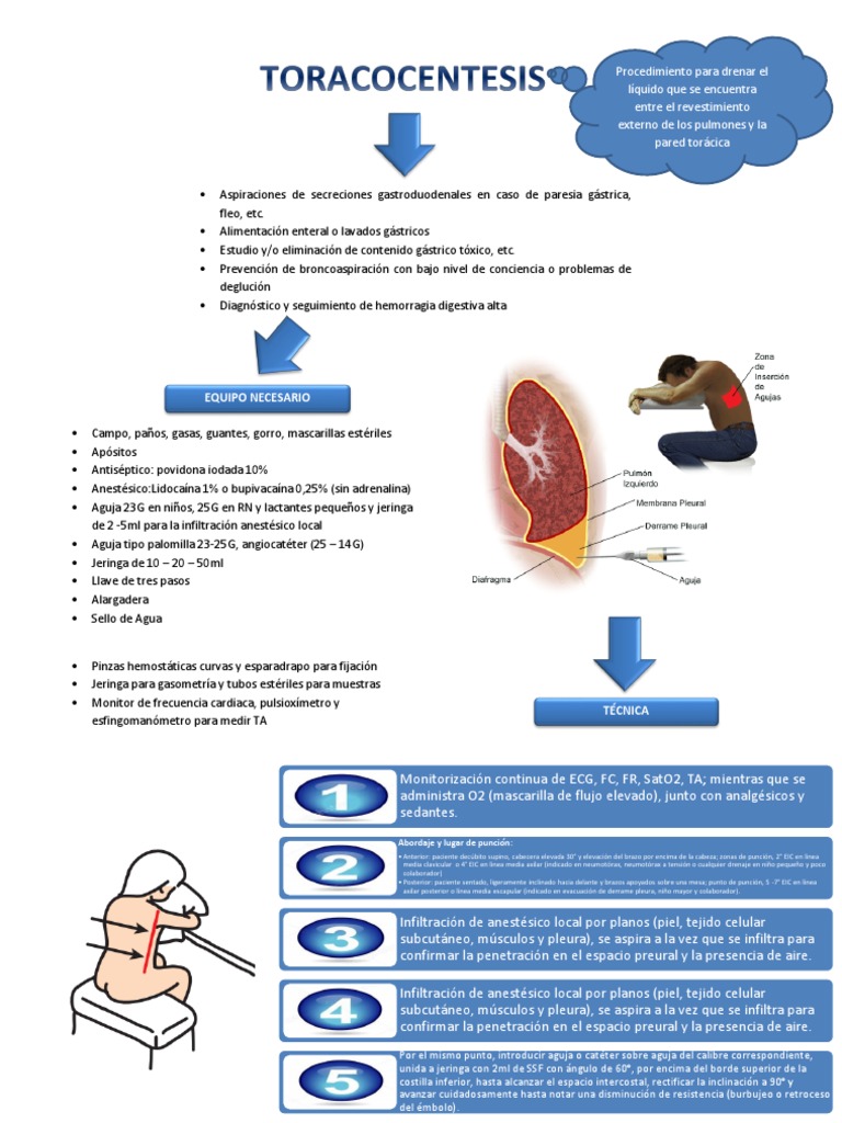 TORACOCENTESIS | PDF | Especialidades Medicas | Medicina CLINICA