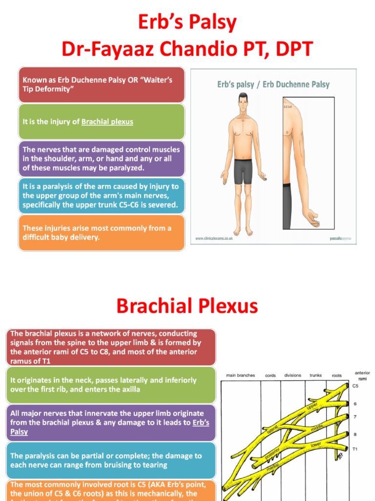 Understanding Erb's Palsy: Causes, Signs, Treatment, and Impact on ...