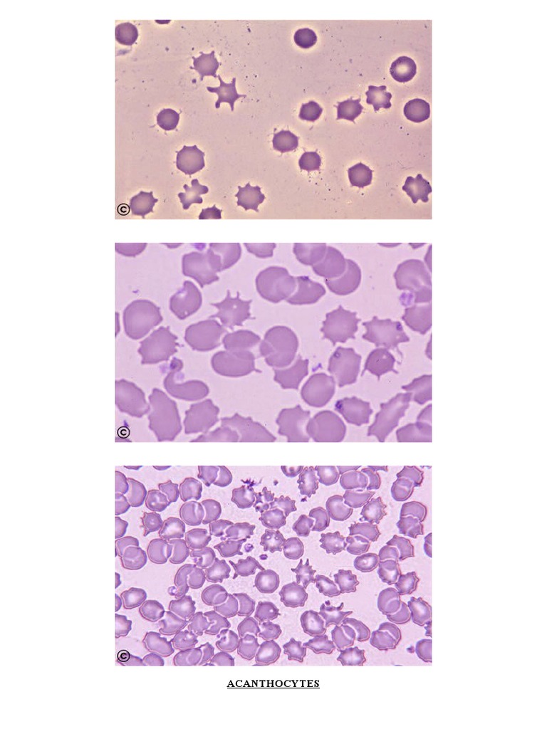 Hematology Atlas Overview | PDF | Wellness | Science & Mathematics