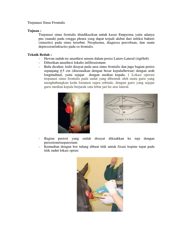 Trepanasi Sinus Frontalis | PDF