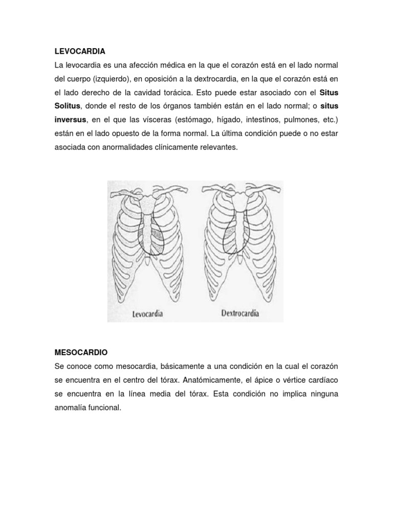 Levocardia y Mesocardia Embrio 2 | PDF | Hogar, jardinería y bricolaje