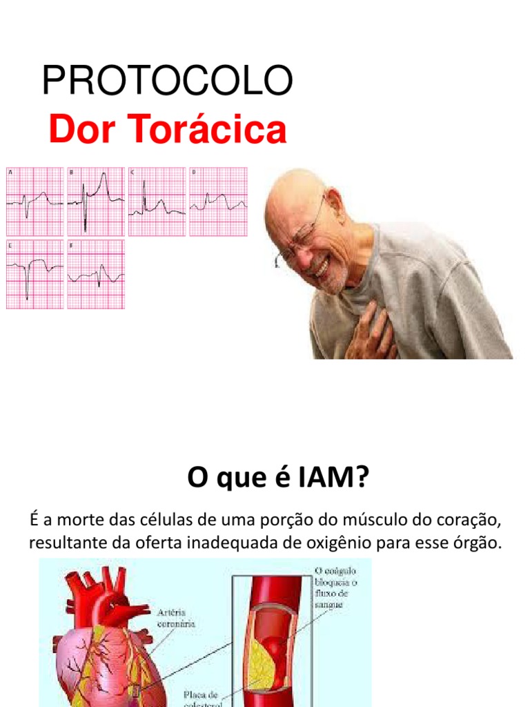 Protocolo de atendimento da dor torácica sugestiva de síndrome coronariana aguda | PDF ...