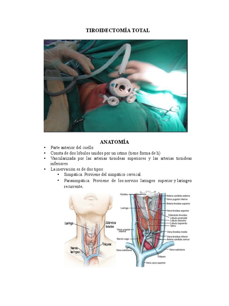 Cirugía de la tiroides: Anatomía, tipos de anestesia y procedimiento ...