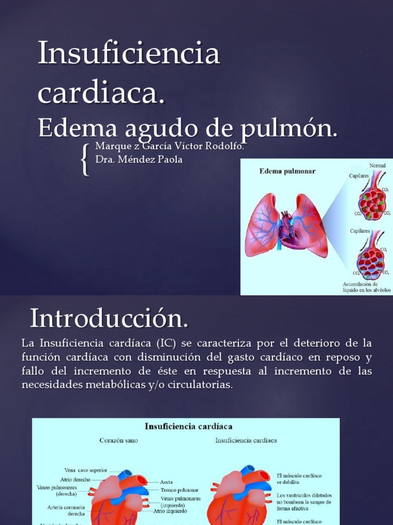 Insuficiencia cardíaca y edema agudo de pulmón: Fisiopatología ...