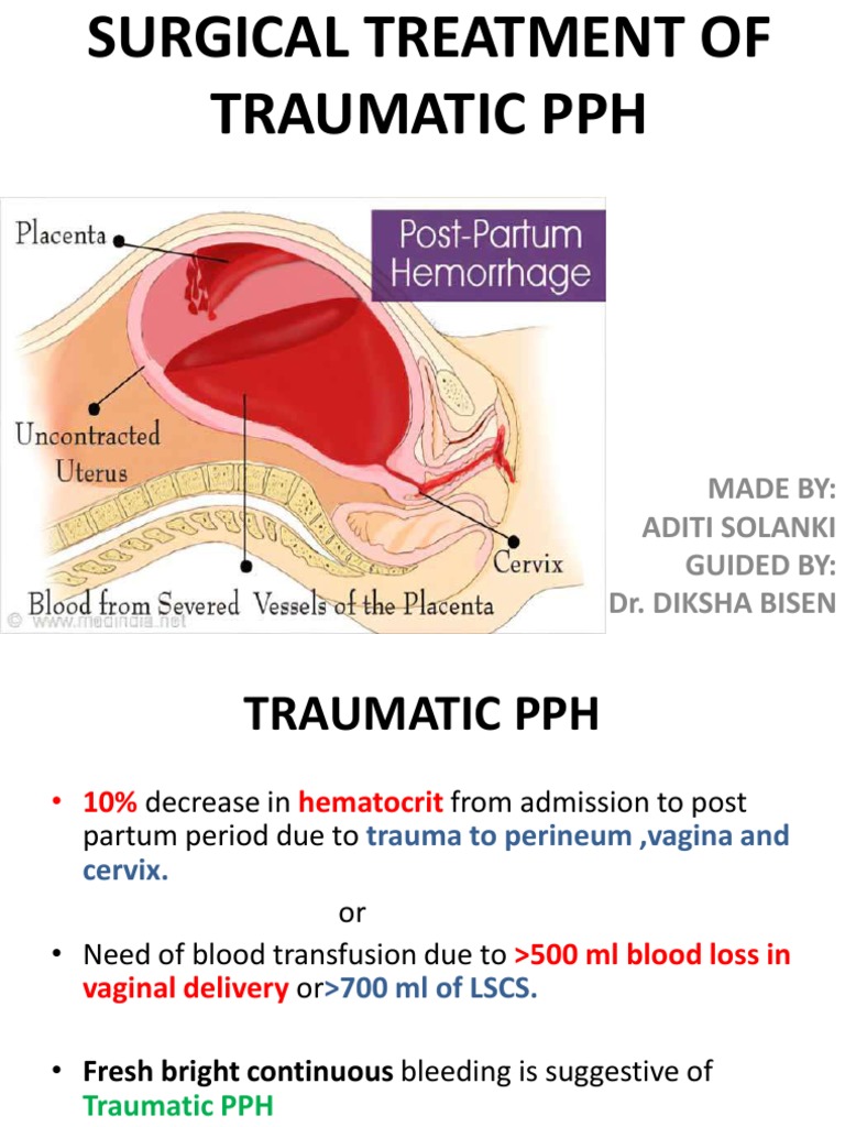 Surgical Treatment of Traumatic PPH | PDF | Childbirth | Vagina