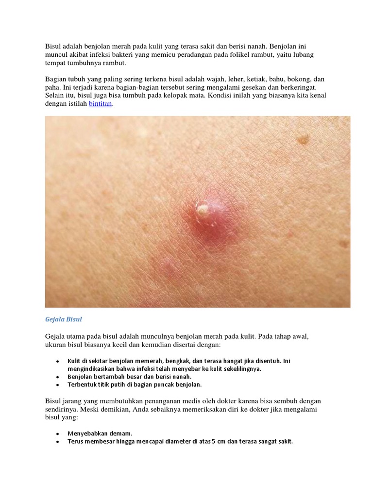 Penyakit Bisul | PDF