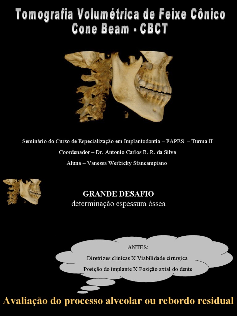 CBCT | PDF | Tomografia computadorizada | Odontologia