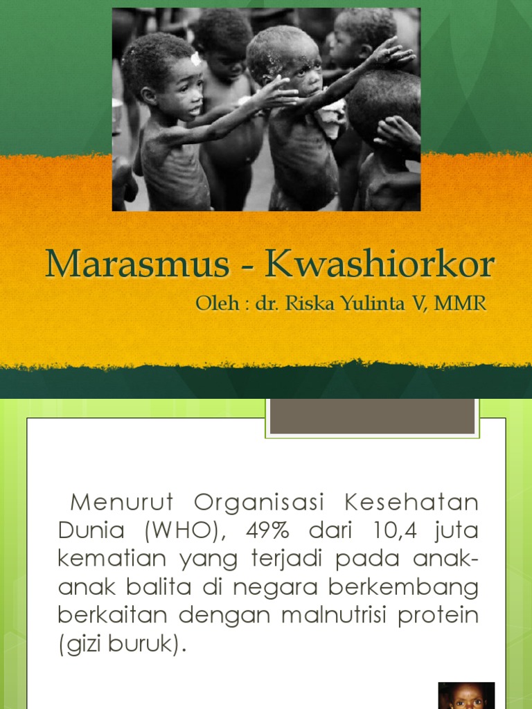 Marasmus & Kwashiorkor | PDF