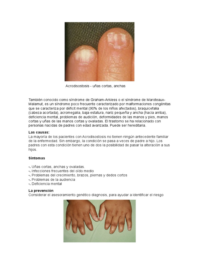 Acrodisostosis | PDF | Clavo (anatomía) | Ciencias de la Salud