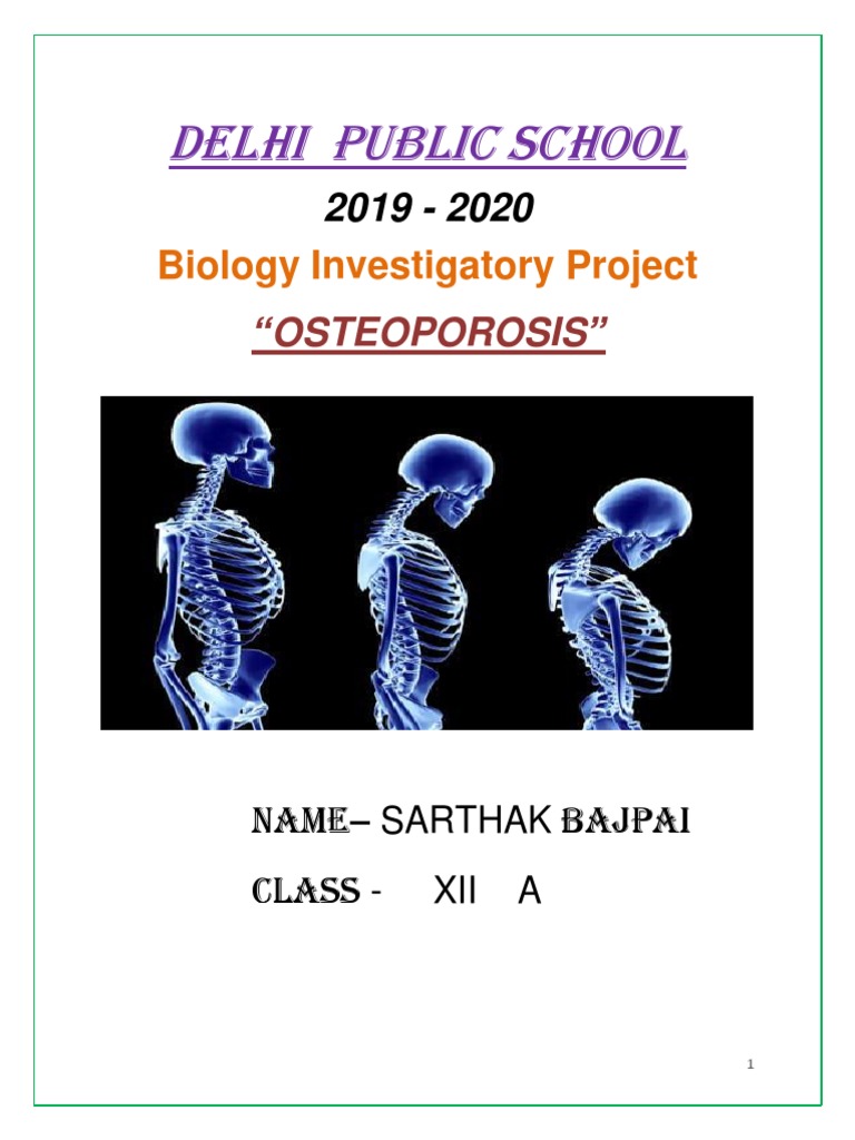 Bio Project Investigatory Project Osteoporosis | PDF | Osteoporosis | Bone