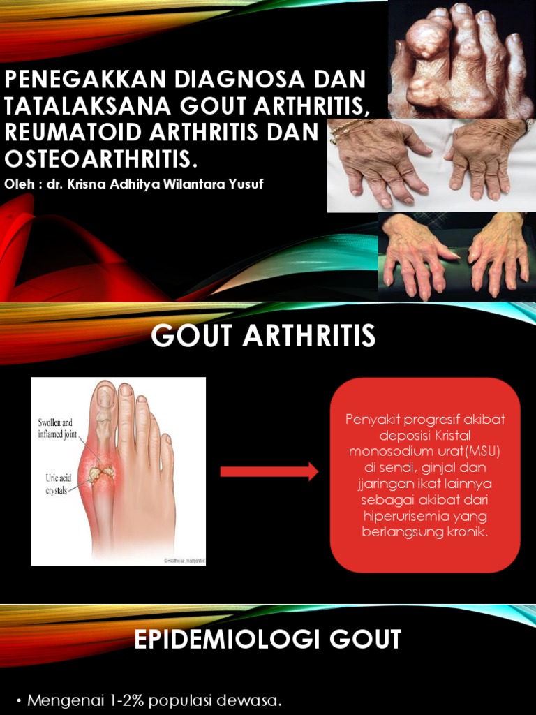 Penegakkan Diagnosa Dan Tatalaksana Gout Arthritis, Reumatoid | PDF