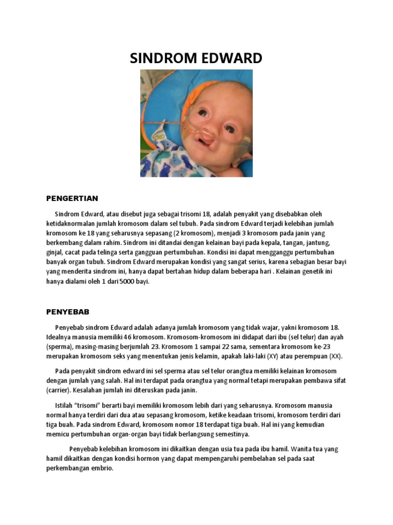 Sindrom Edward | PDF