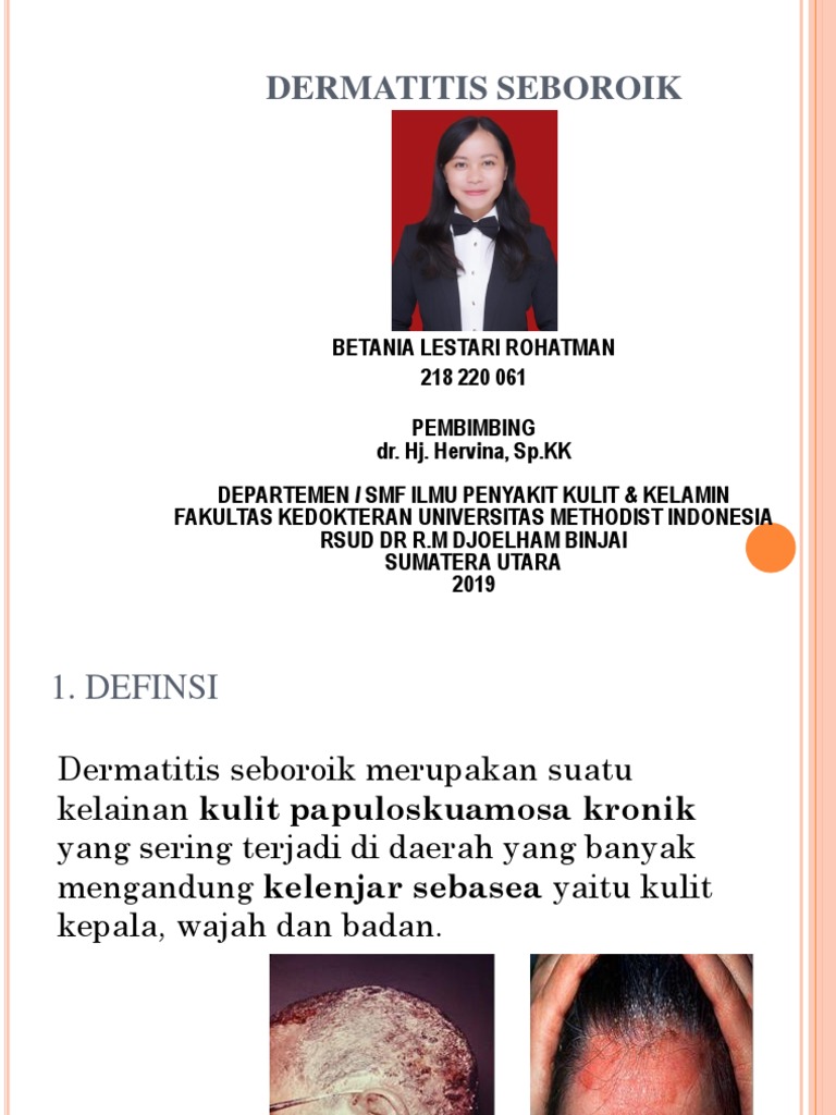 Dermatitis Seboroik: Diagnosis dan Penanganan | PDF