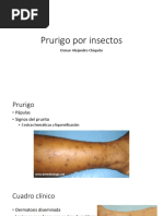 CAPÍTULO 17 - Prurigo Por Insectos (Cimiciasis) | PDF | Insecticida ...
