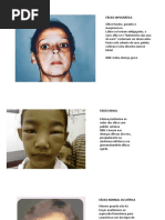 Tipos de Fácies e Suas Características | PDF | Rosto | Especialidades ...
