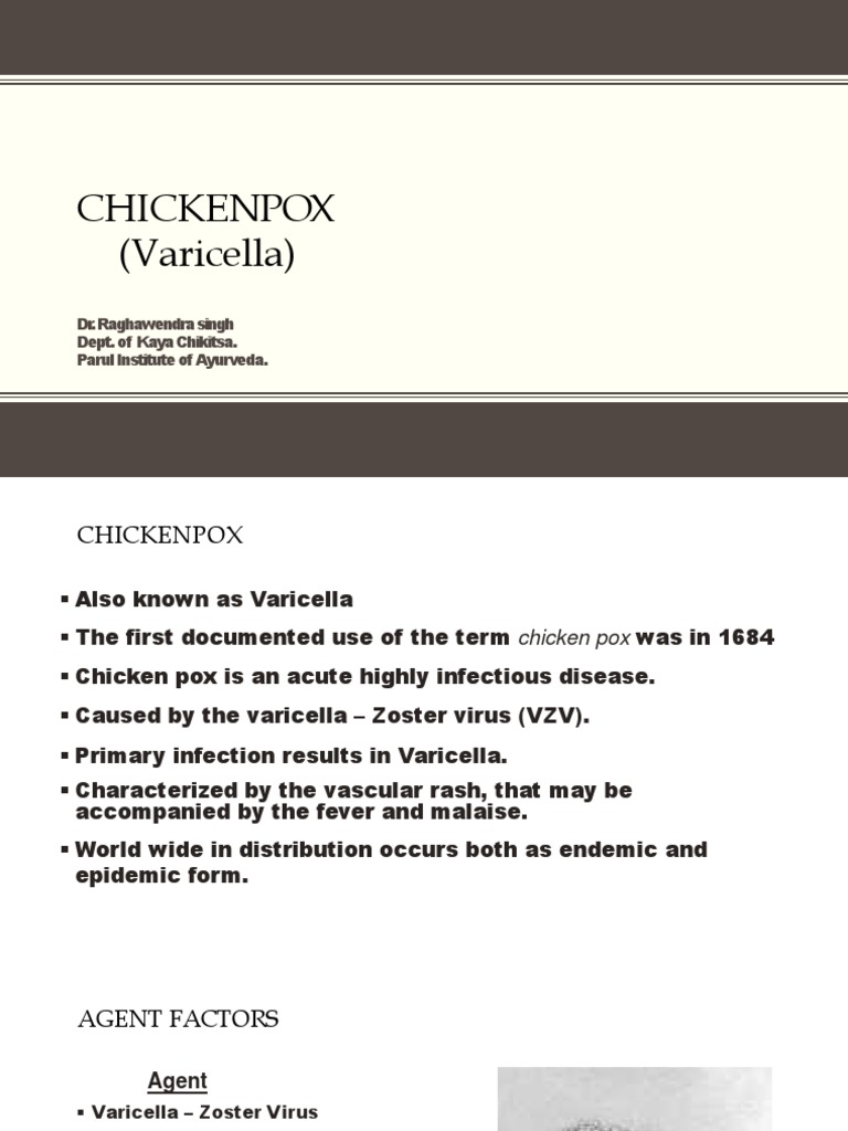 A Brief Note On: Chicken Pox | PDF | Public Health | Veterinary Medicine