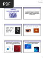 Tecnica Faco+lio+vitrectomia+retinopexia | PDF | Catarata | Oftalmología