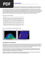 Full Brainwave Frequencies Table | PDF | Neural Oscillation | Trance