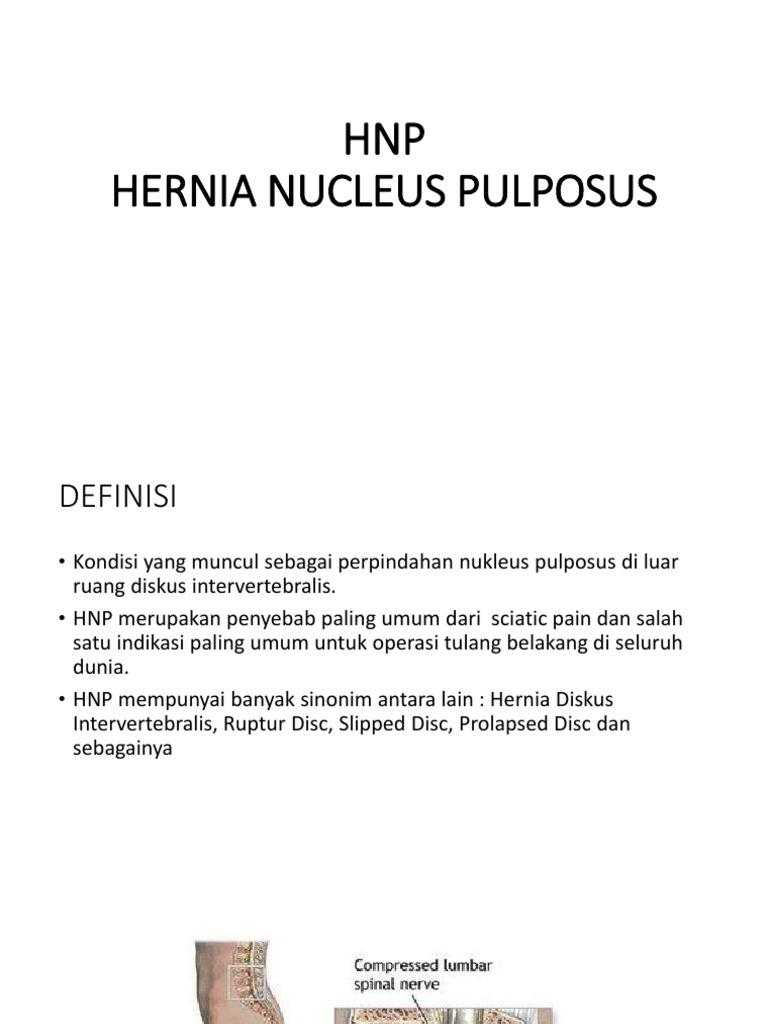 Panduan Lengkap Hernia Nukleus Pulposus | PDF | Pengembangan Diri ...