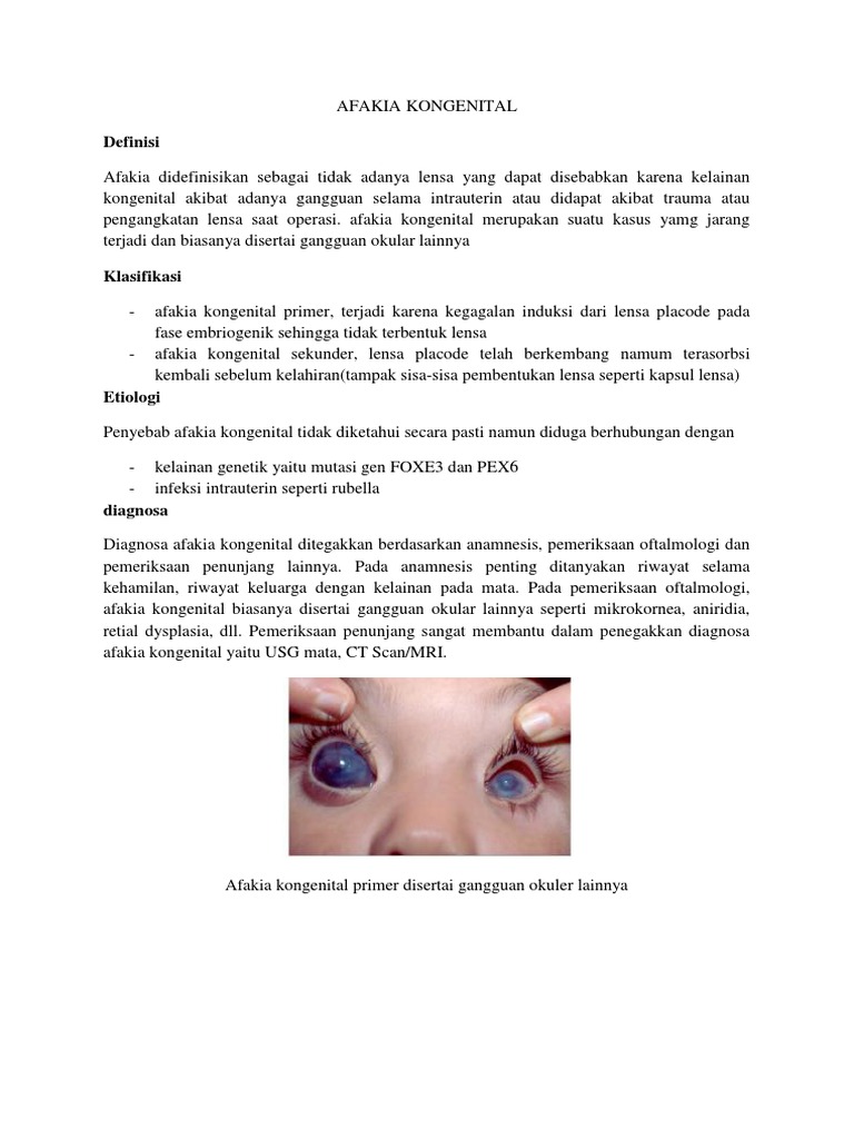 Afakia Kongenital | PDF