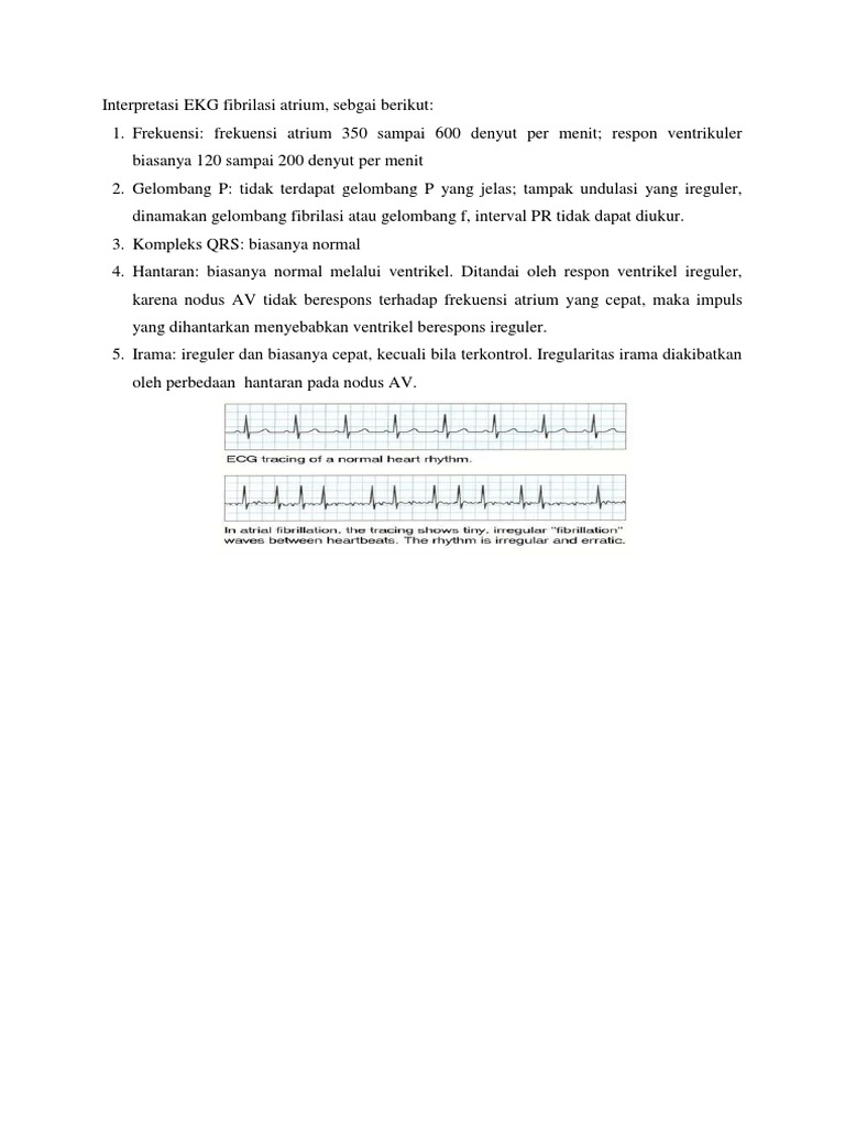EKG Fibrilasi Atrium: Panduan Medis | PDF | Klasik