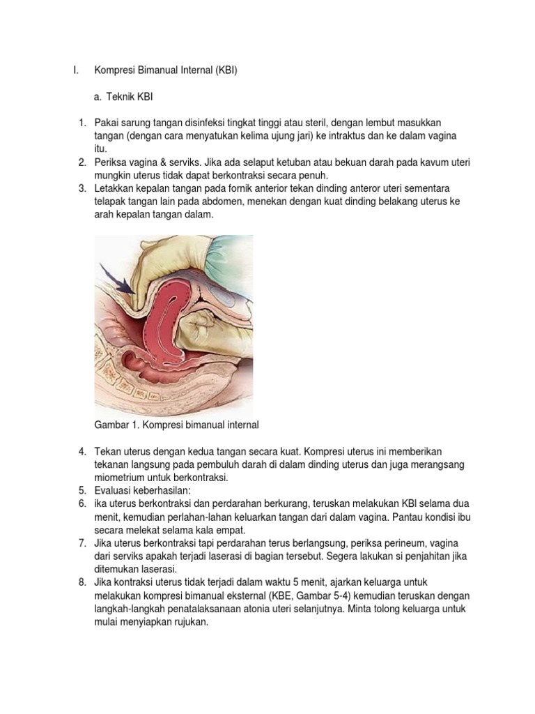 Kompresi Bimanual Internal | PDF