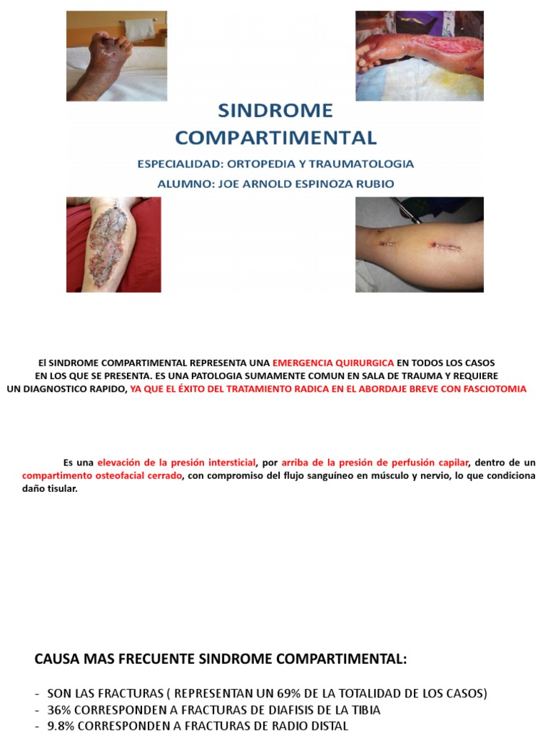 Sindrome Compartimental | PDF | Hemodinámica | Mano