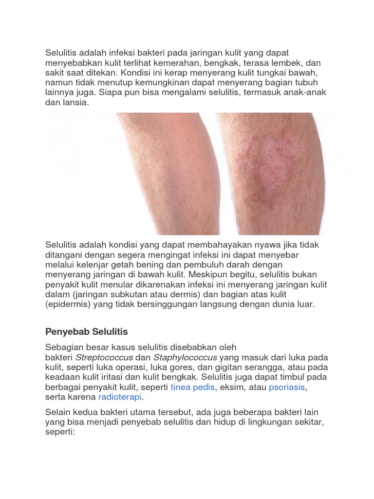 PENGOBATAN DAN KOMPLIKASI SELULITIS | PDF