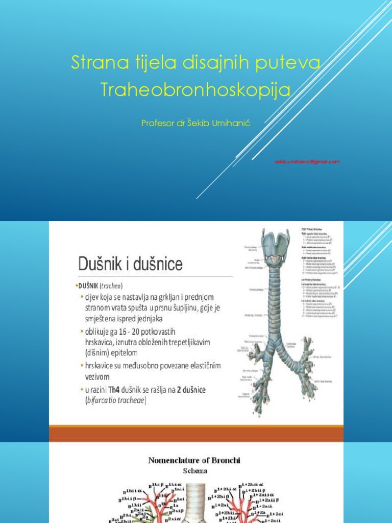 Disajni Putevi I Strano Tijelo | PDF