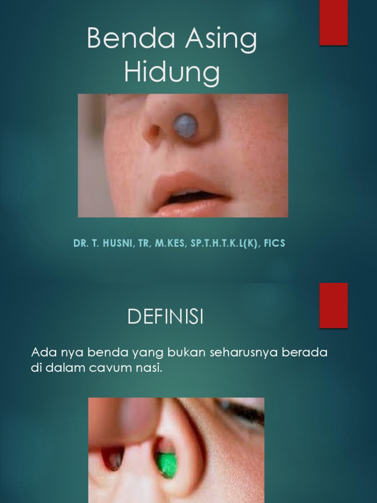 Ekstraksi Benda Asing di Hidung | PDF